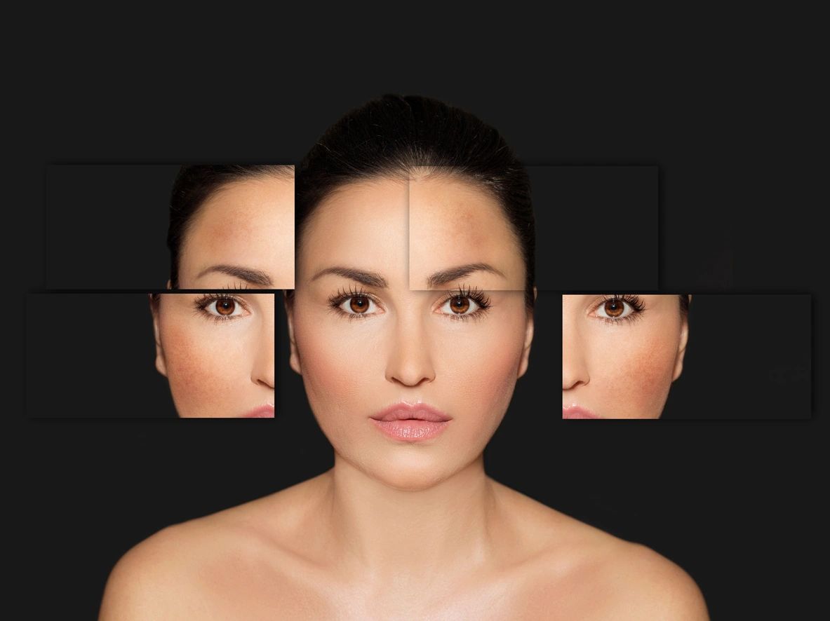 SMOKING AND ATOPIC DERMATITIS - RSB Skincare
